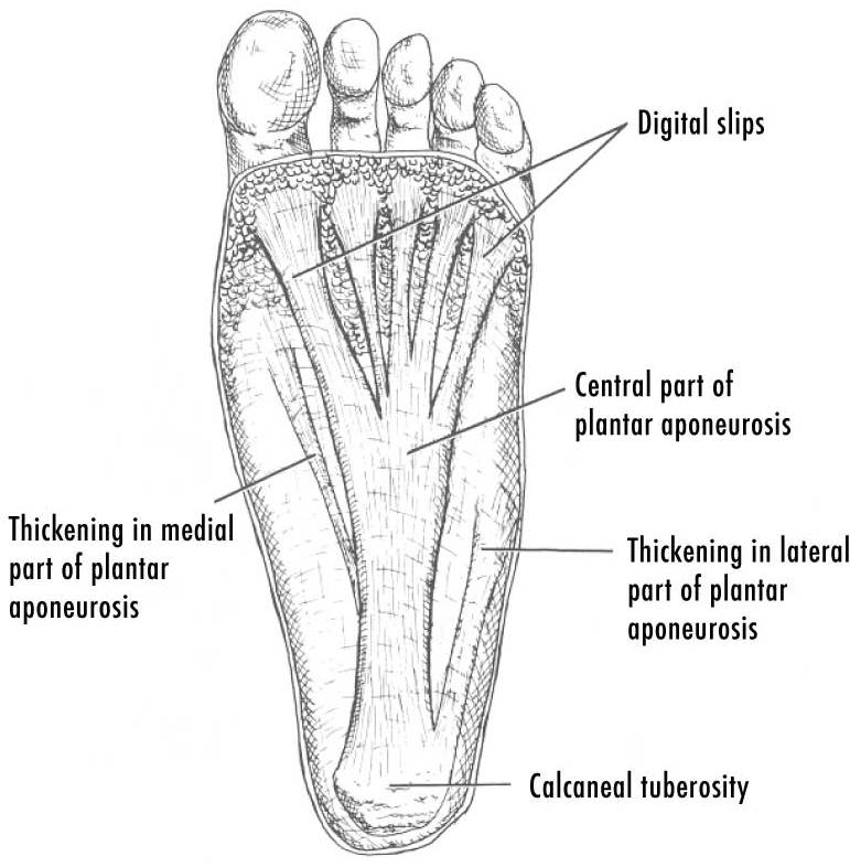 Plantar Heel Pain |Buchanan Orthotics