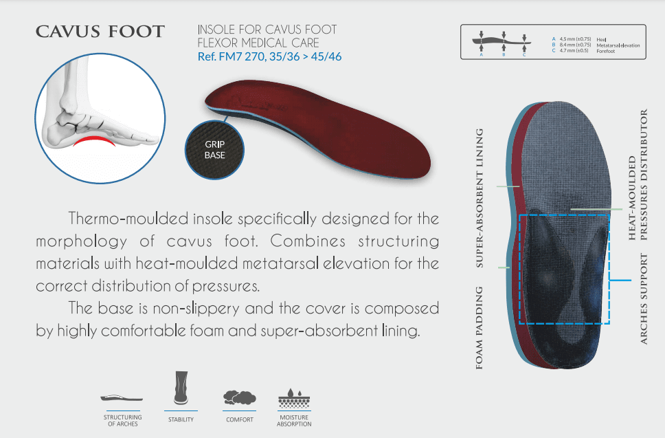 Flexor Cavus | Buchanan Orthotics